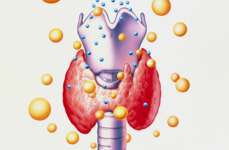 იოდი აუცილებელი ელემენტი - მკურნალი.გე