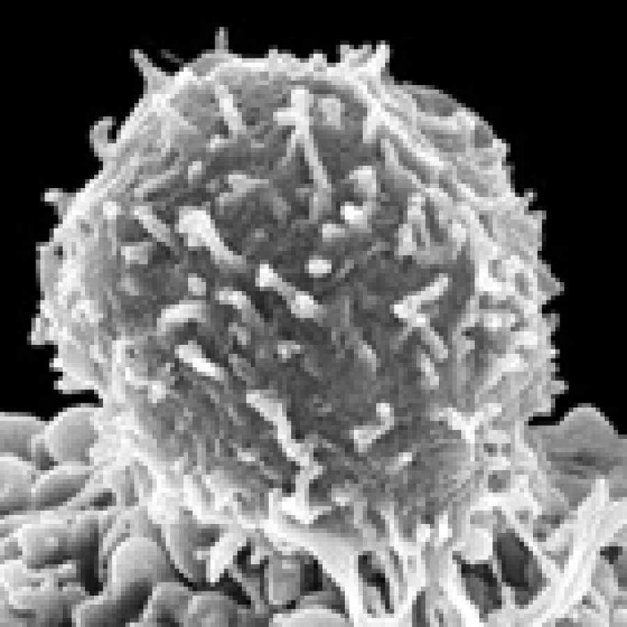 სოკოვანი ინფექციების მიმართ მგრძნობიარე გენები - მკურნალი.გე